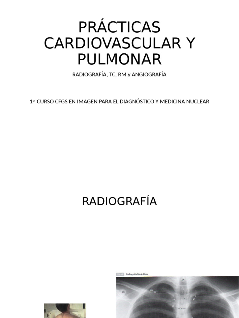 Cardiovascular y Pulmonar Alumnos Crit c | PDF Cardiovascular y Pulmonar Alumnos Crit c | PDF