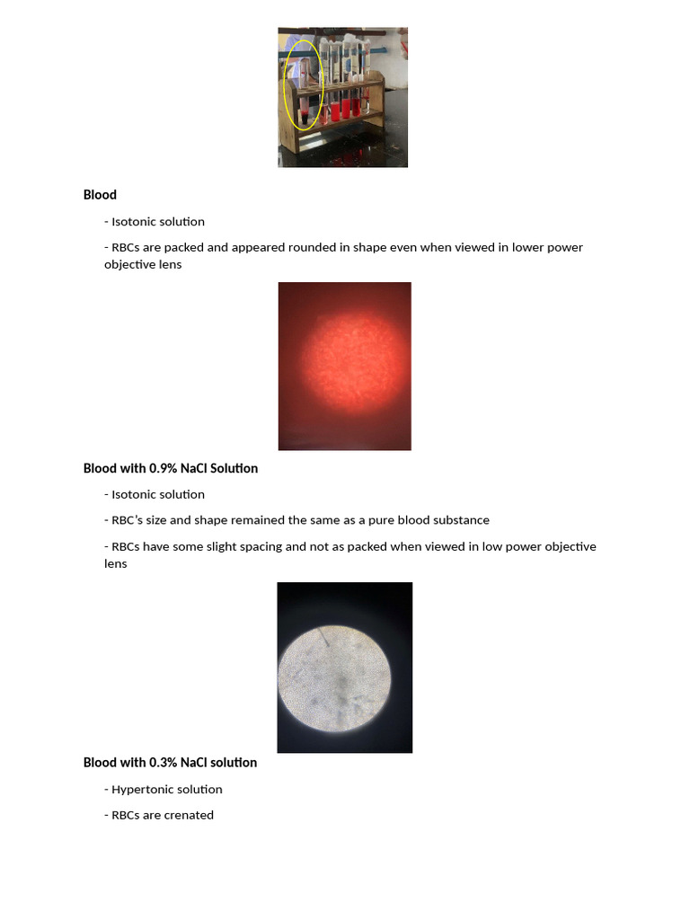 Blood-solutions | PDF