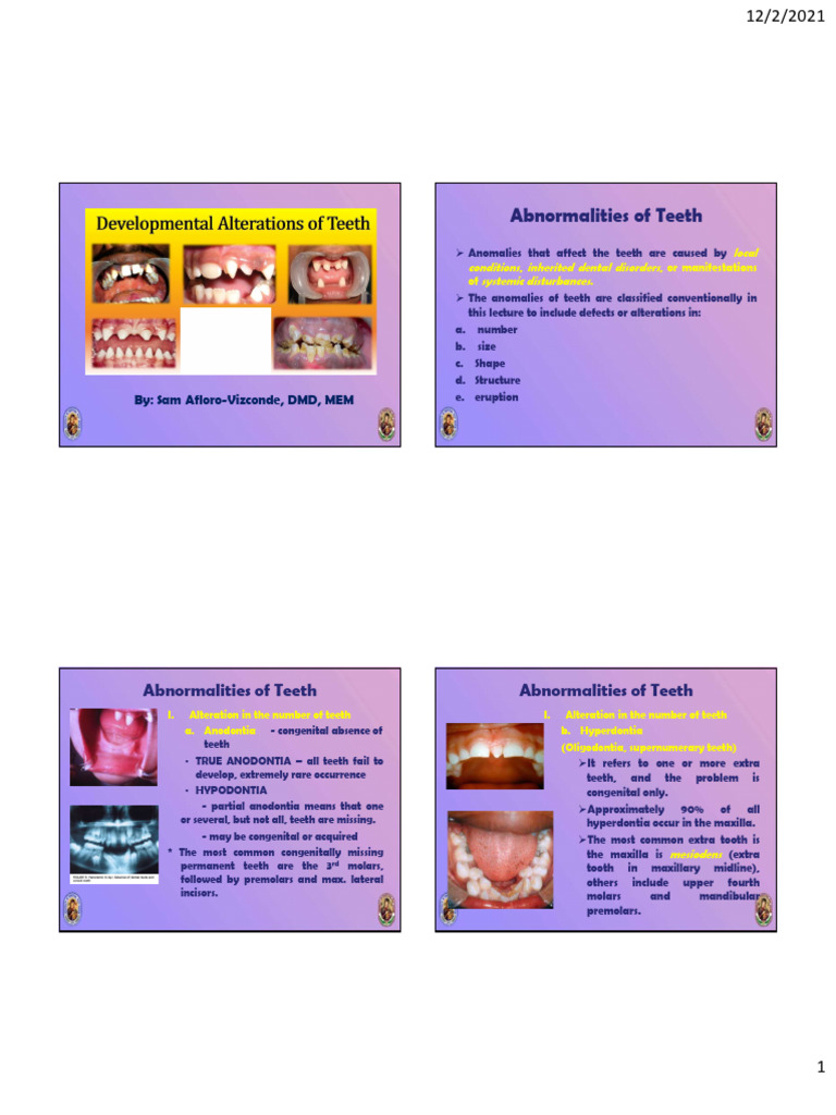 Dental Anomalies Overview | PDF