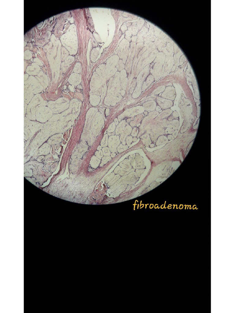 Patho All Slides Compiled | PDF