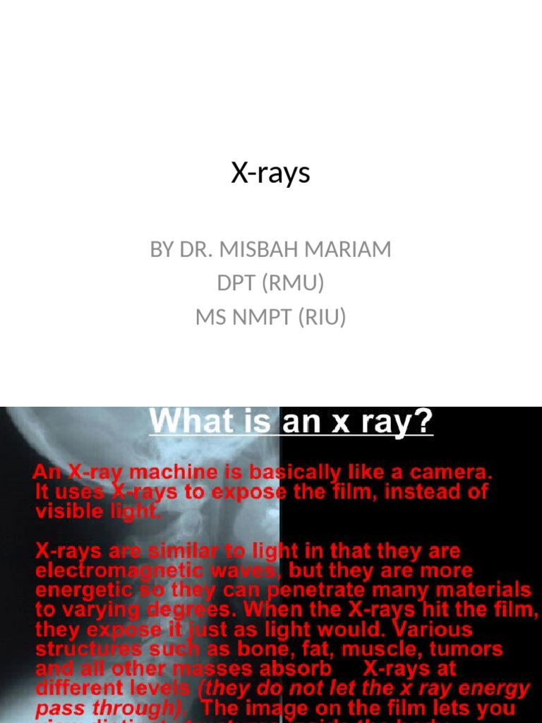 X rays | PDF