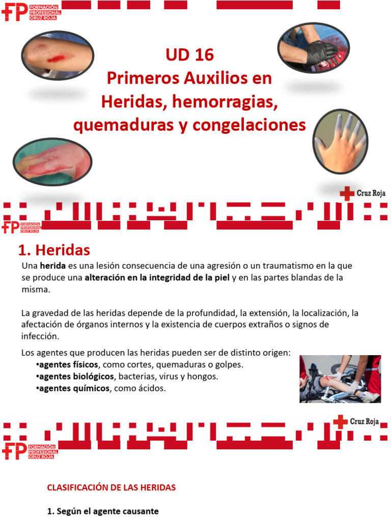 UD 16 Primeros Auxilios en Heridas, Hemorragias, Quemaduras y Fracturas. | PDF | Herida | Quemar