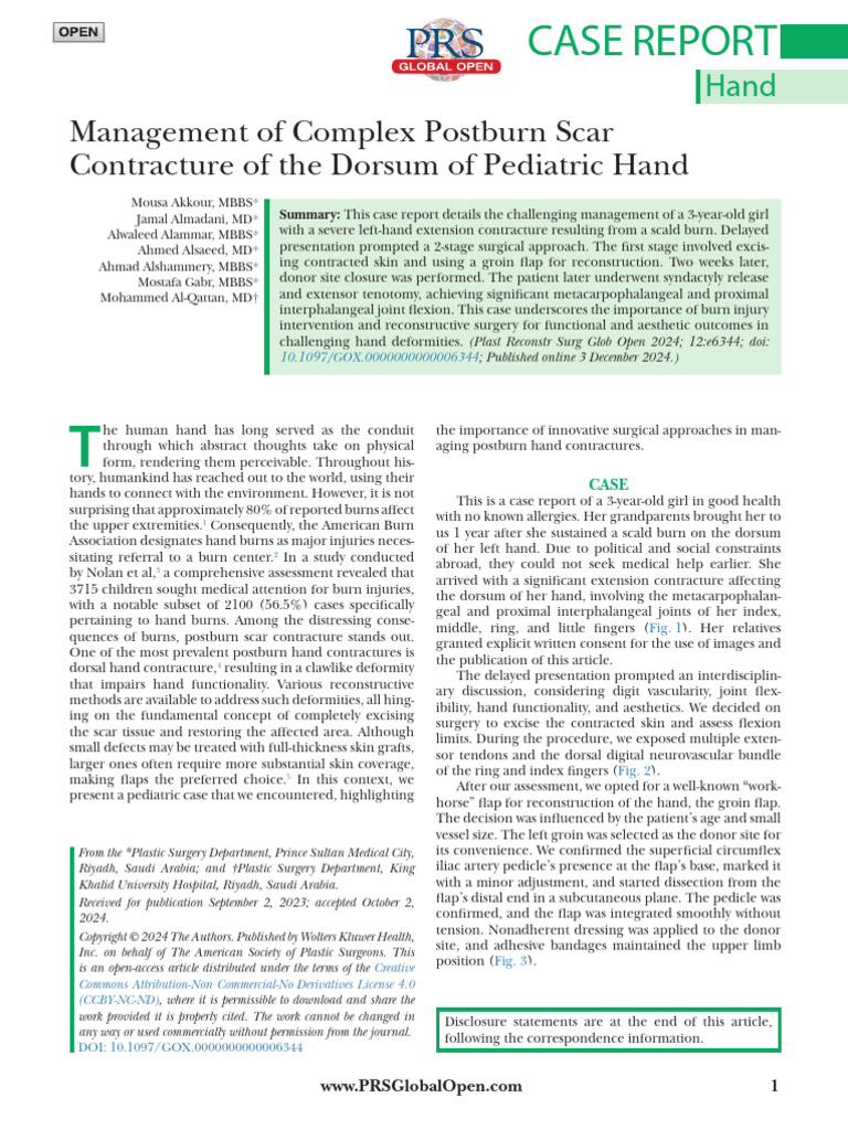 Management of Complex Postburn Scar Contracture Of.1 | PDF | Hand | Burn