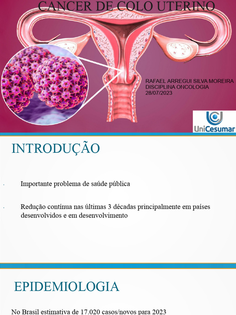 Câncer de Colo Uterino: Epidemiologia e Tratamento | PDF | Câncer ...