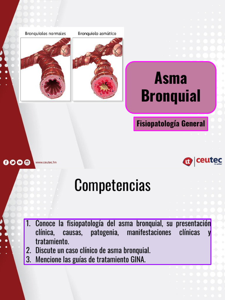 S4D1 Fisiopatología Del Asma Bronquial, EPOC y Derrame Pleural | PDF ...
