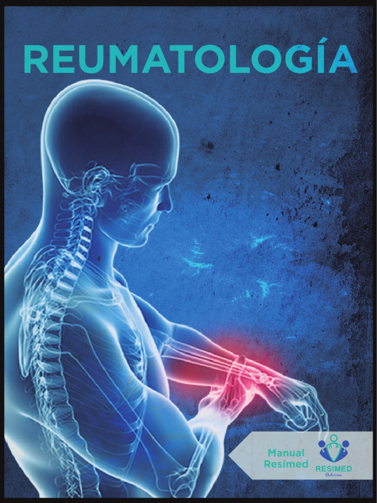 Reumatologia | PDF | Gota | Anticuerpo