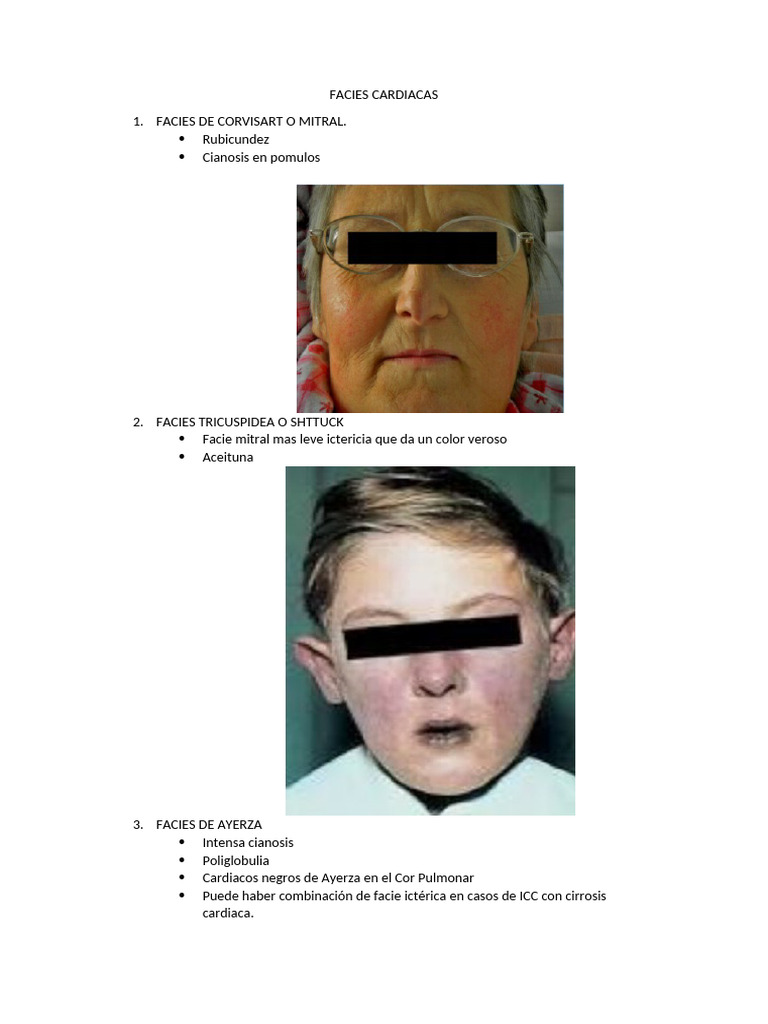 Tipos de Facies Cardíacas y Sus Características | PDF
