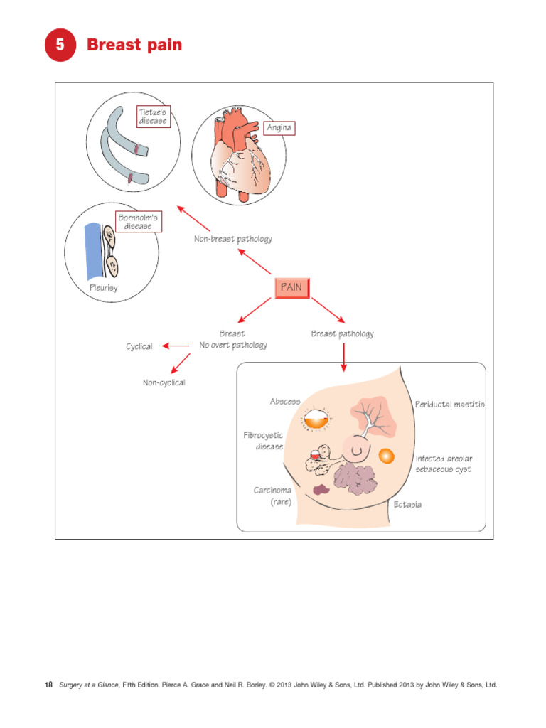 Breast Pain | PDF