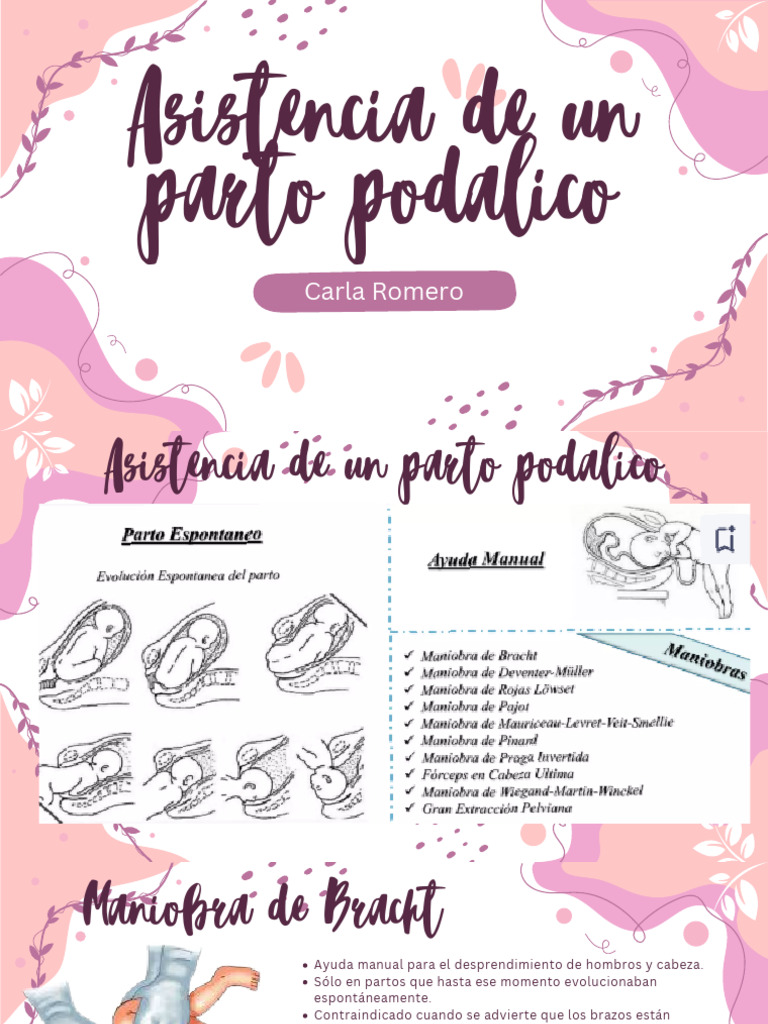 Maniobras para Parto Podálico Efectivas | PDF | Pelvis | Mano