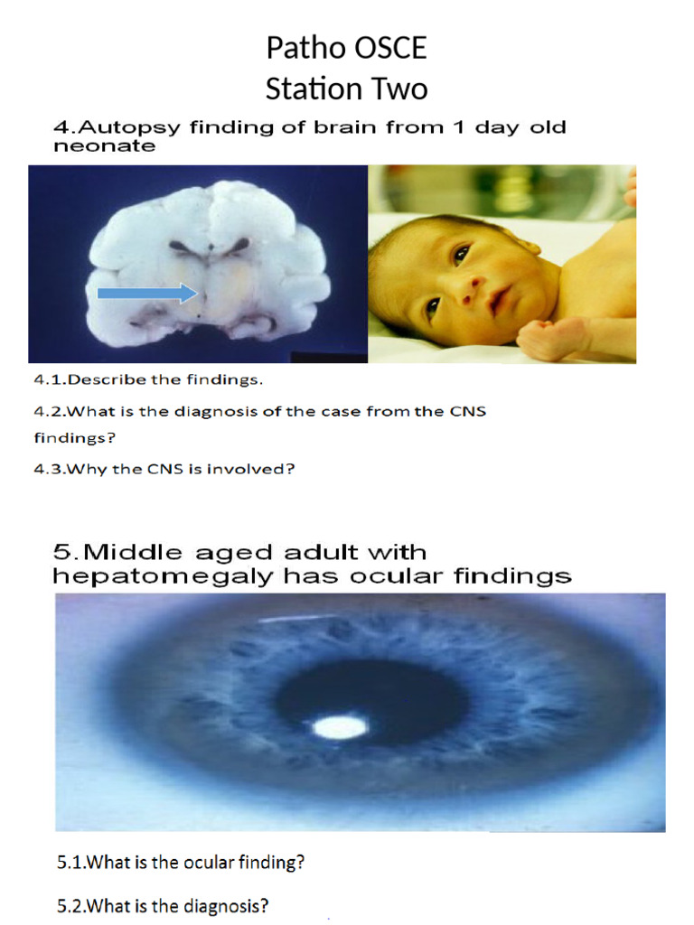 Patho OSCE GIT 2 | PDF