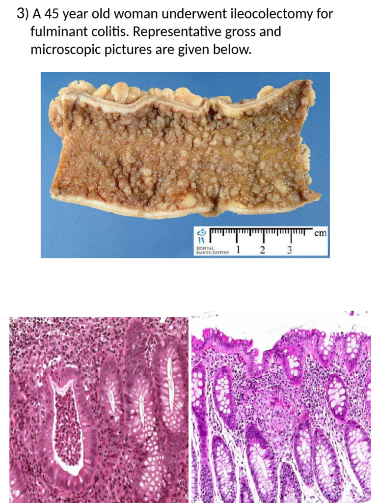 Pathology Case Studies for Medical Students | PDF