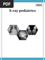 Bone Age Specific X-Rays | PDF