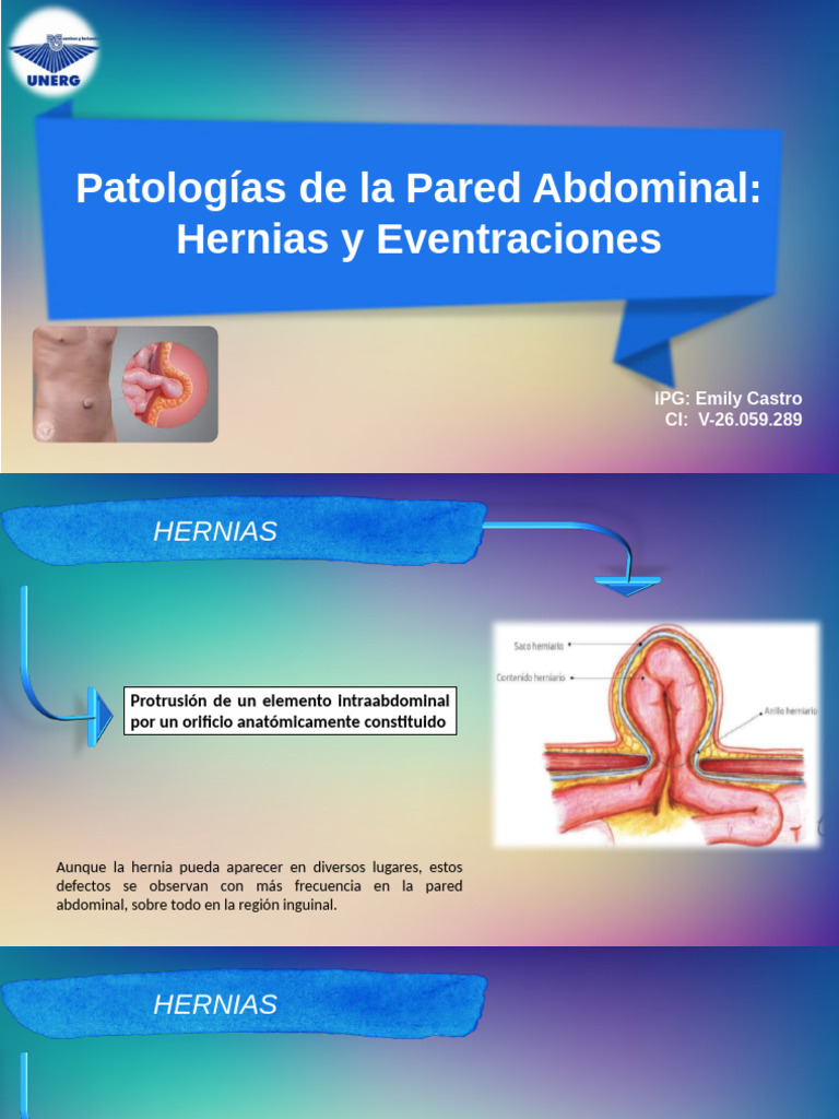 EMI Hernias y Eventraciones | PDF | Abdomen | Examen físico