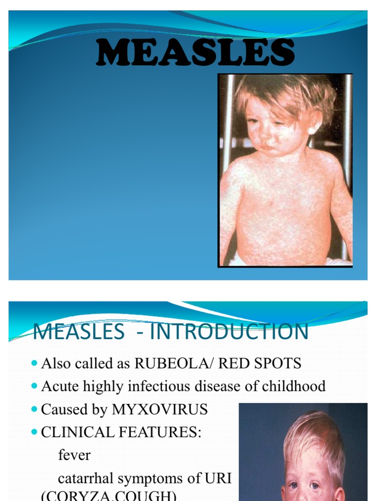 Measles: An Overview of the Disease Including Epidemiology, Clinical ...