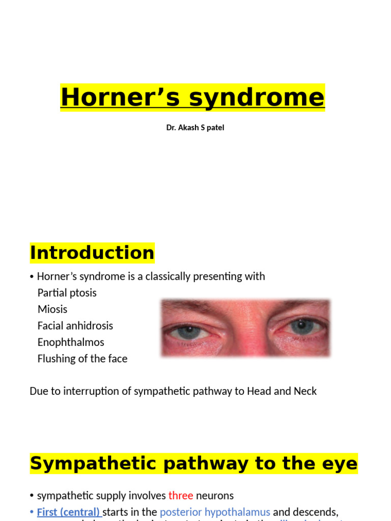 Horner’s Syndrome | PDF | Common Carotid Artery | Neck