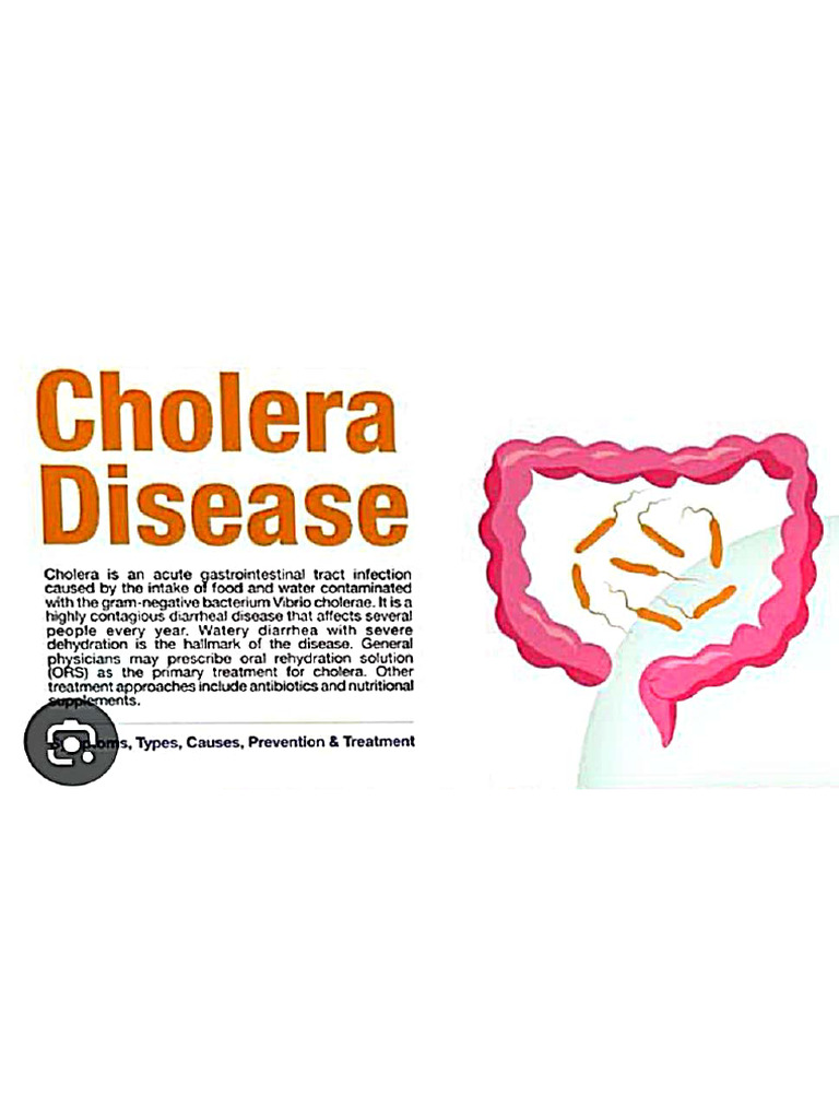 Cholera | PDF