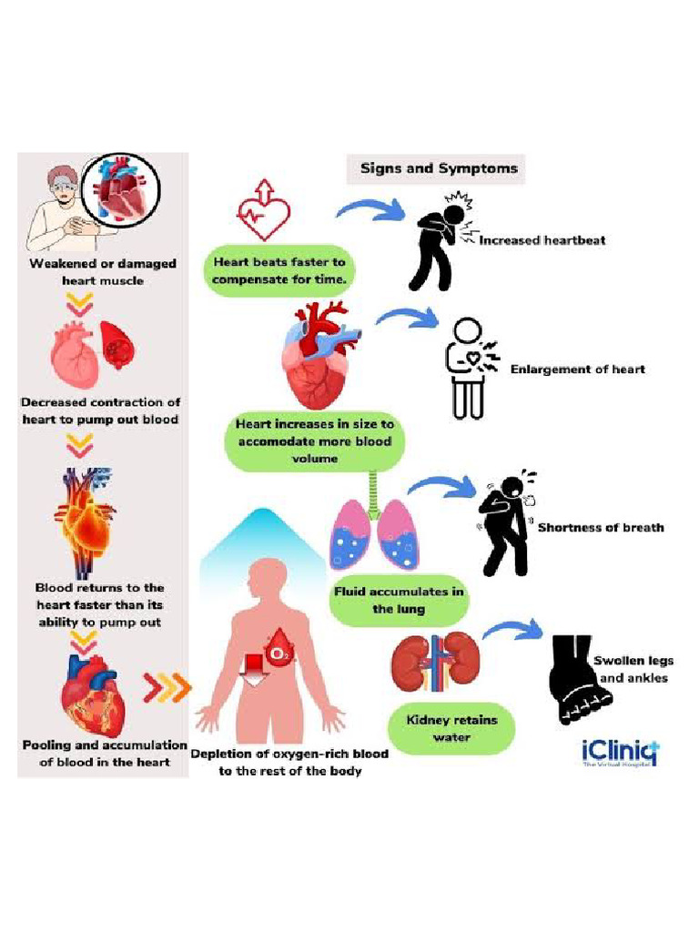 Chronic Heart Failure | PDF