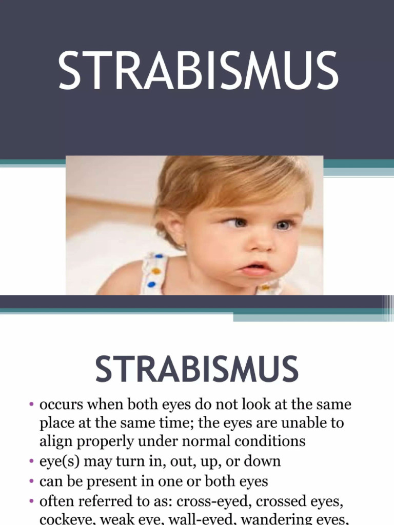 Strabismus | PDF