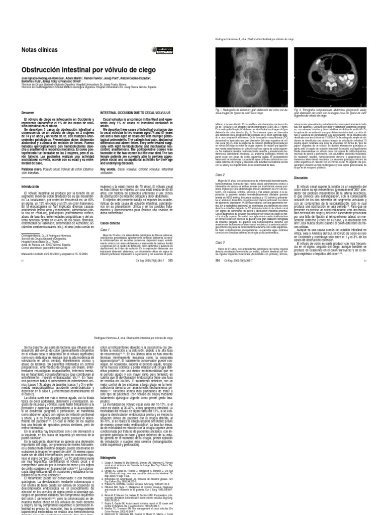 Obstrucción Intestinal Por Vólvulo de Ciego | PDF | Enfermedades ...
