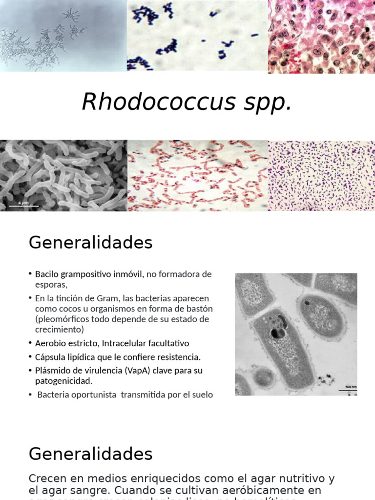 Rhodococcus SPP | PDF | Las bacterias | Macrófago