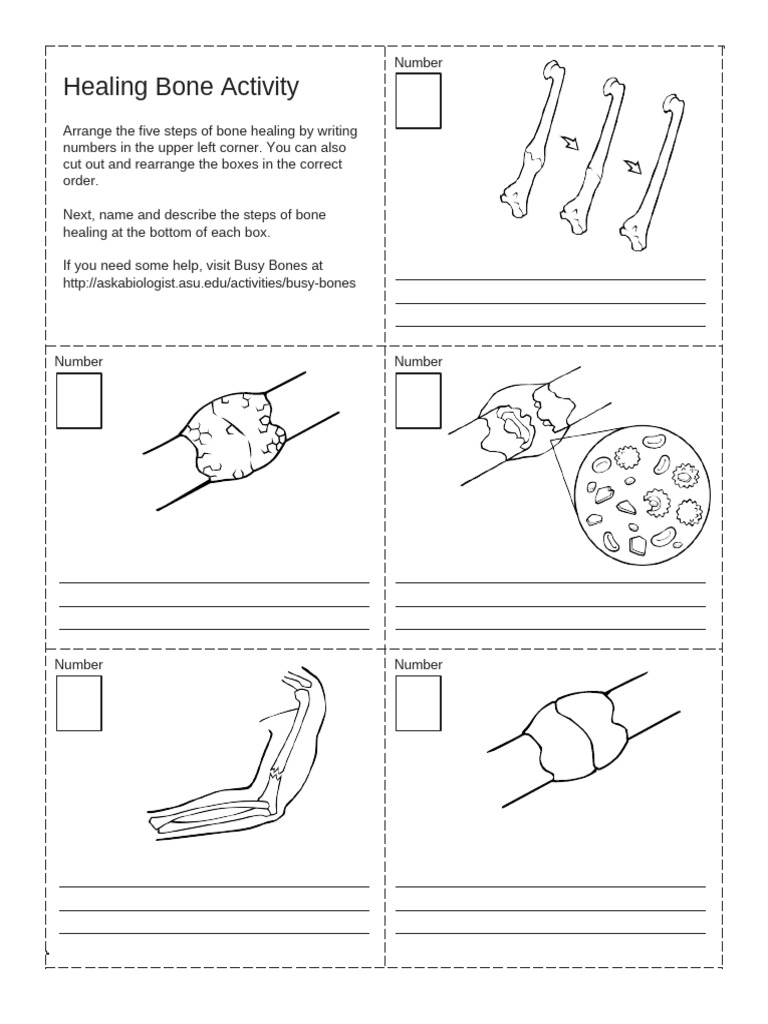 Bone Healing Steps Activity Guide | PDF