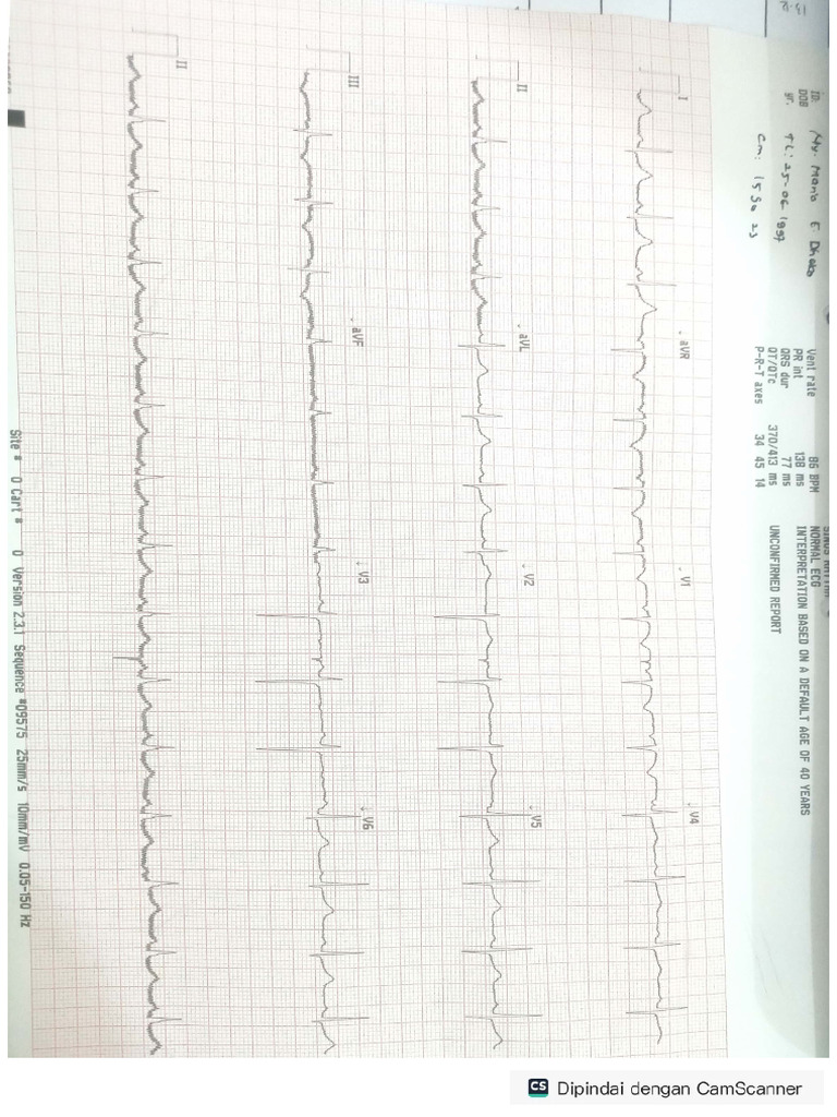 Ekg Dheko | PDF