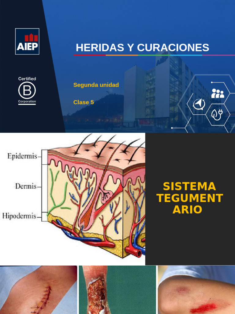 Clase #6 Heridas | PDF | Herida | Enfermedades y trastornos