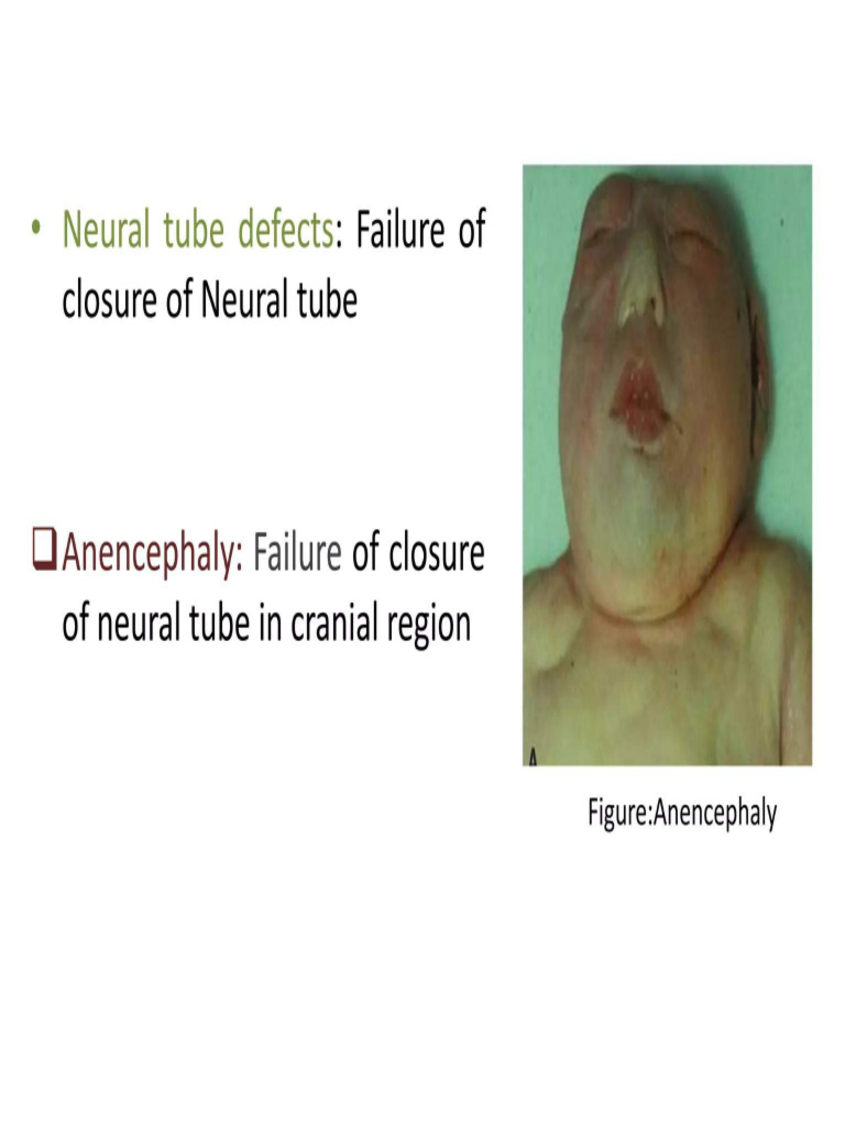 Document 100 101 Compressed | PDF