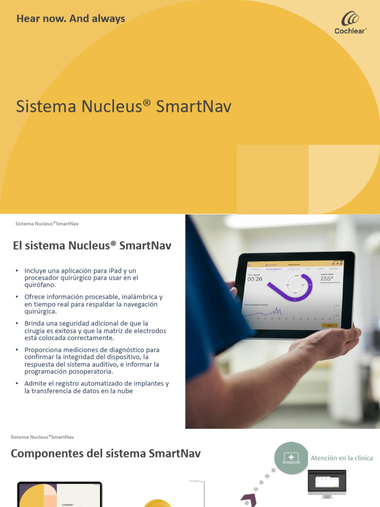 Sistema Nucleus®SmartNav - ES | PDF | Software | Yo pad