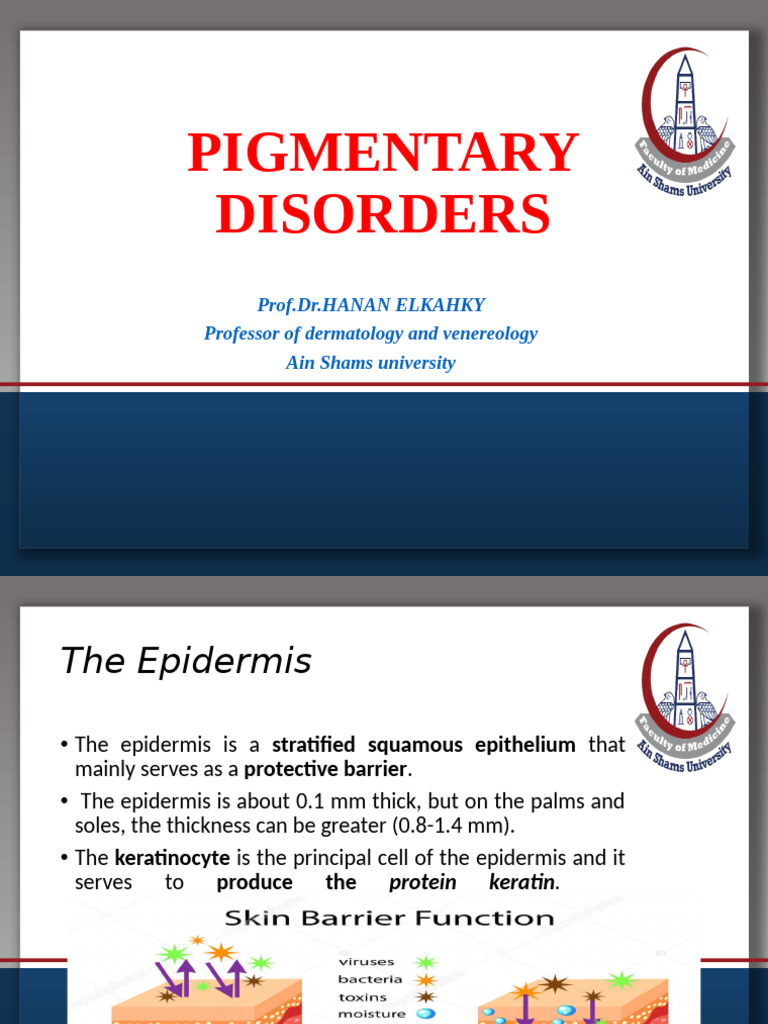 Understanding Pigmentary Disorders | PDF | Epidermis | Ultraviolet