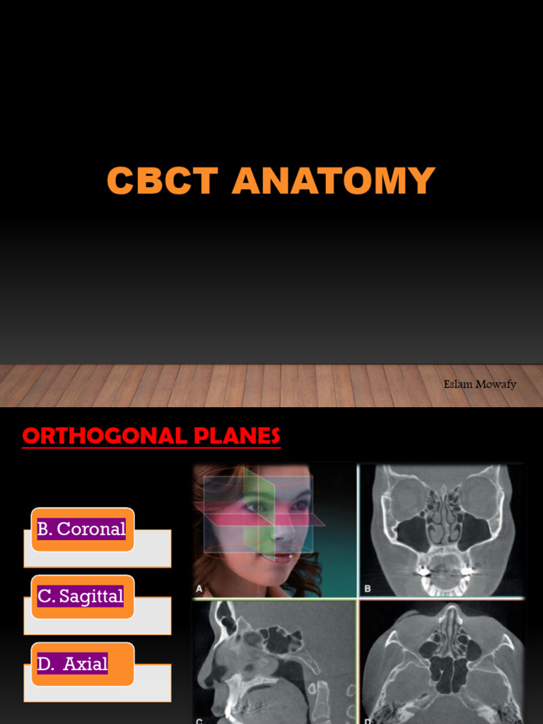 CBCT Anatomy | PDF
