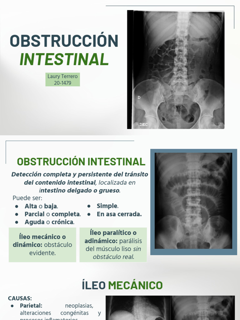 Obstrucción Intestinal: Tipos y Causas | PDF | Enfermedades digestivas ...