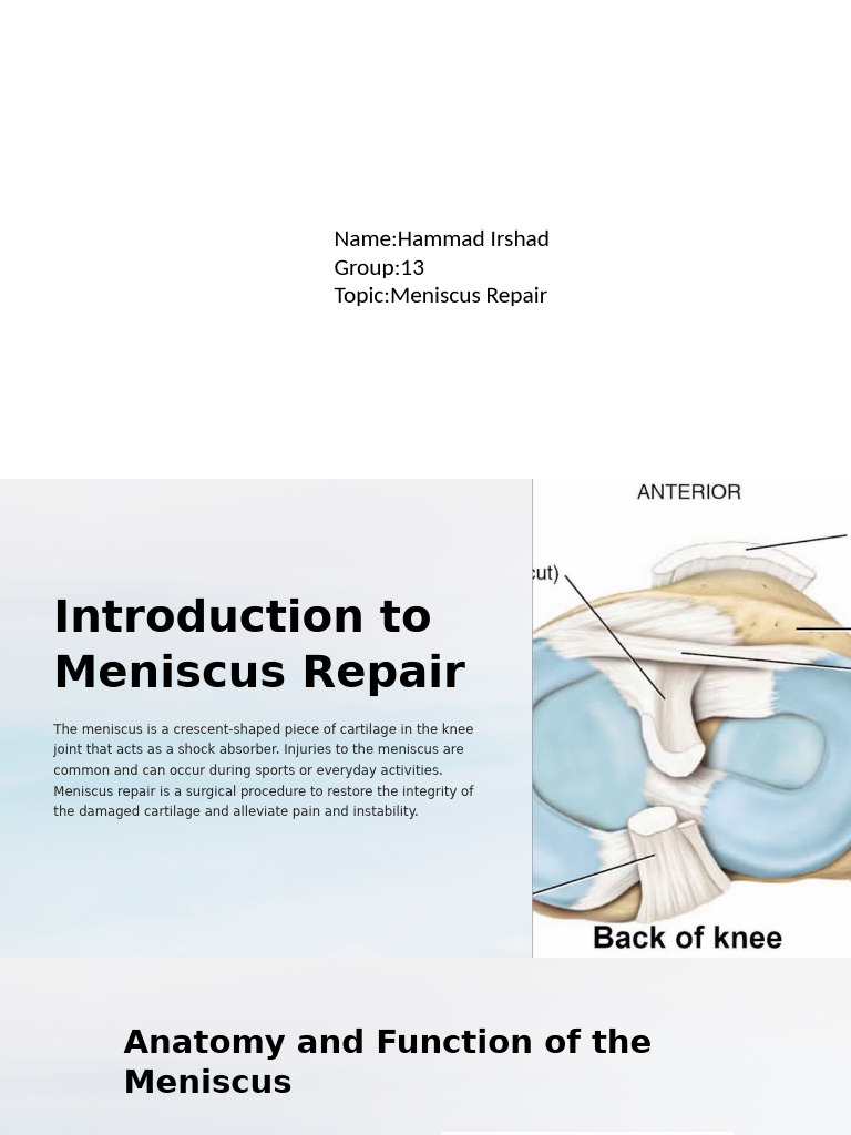 Meniscus Repair: Overview and Protocols | PDF | Knee | Musculoskeletal ...