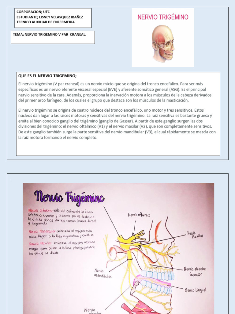 Presentacion Nervio Trigemino Lisney Velasquez 2 PDF | PDF | Anatomía ...