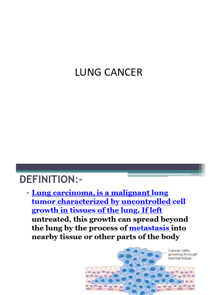 Lung Cancer | PDF | Lung Cancer | Cancer