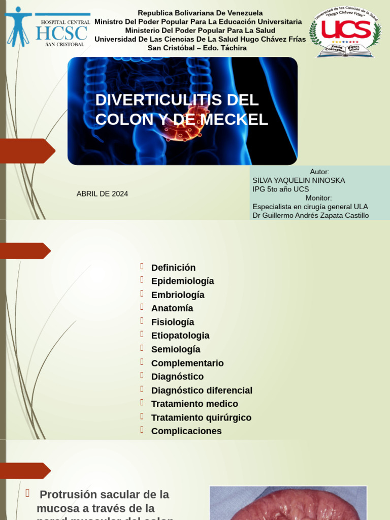 Diverticulo de colon y meckel yaquelin | PDF | Enfermedades y ...