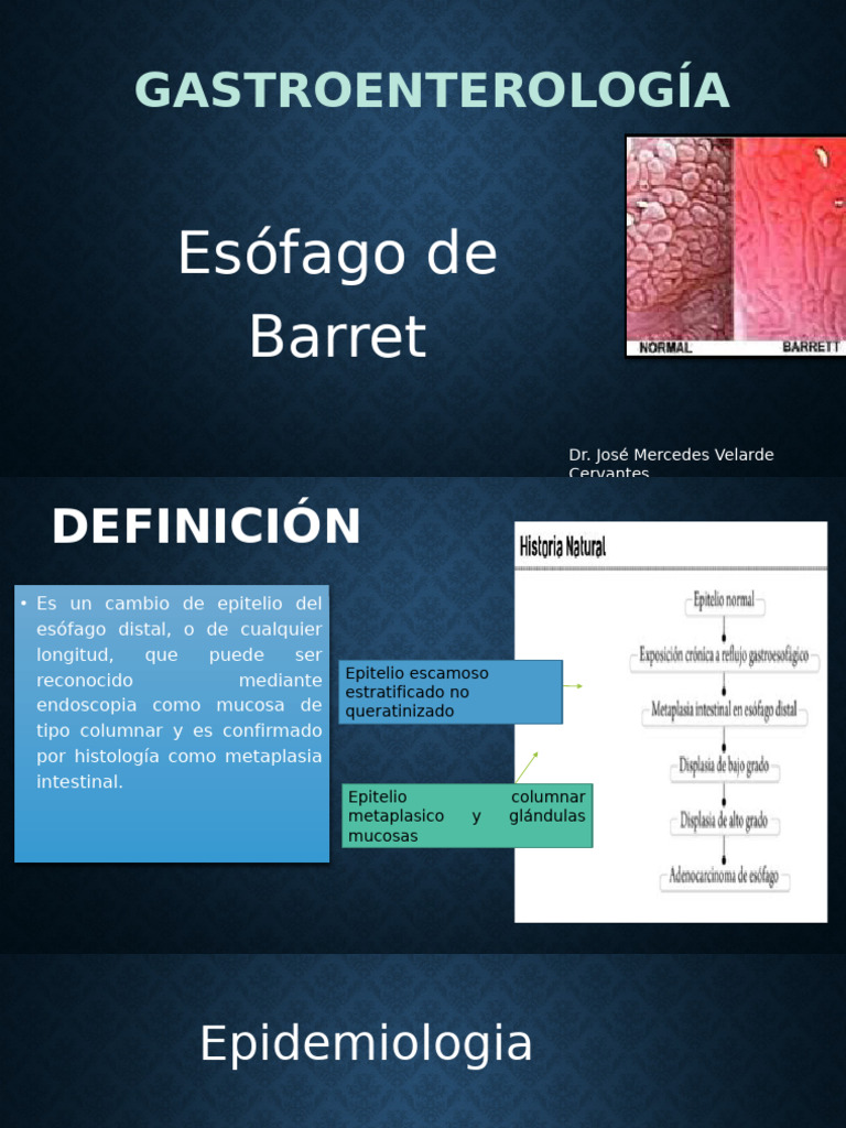 Esofago de Barret | PDF | La enfermedad por reflujo gastroesofágico ...