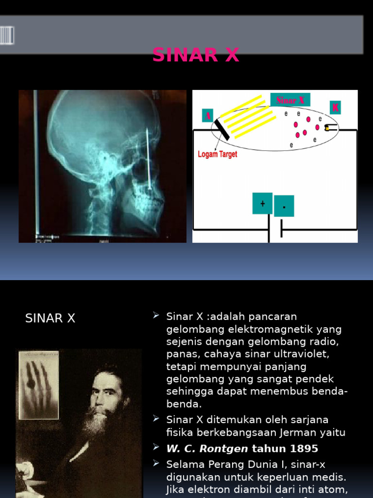Sinar X | PDF
