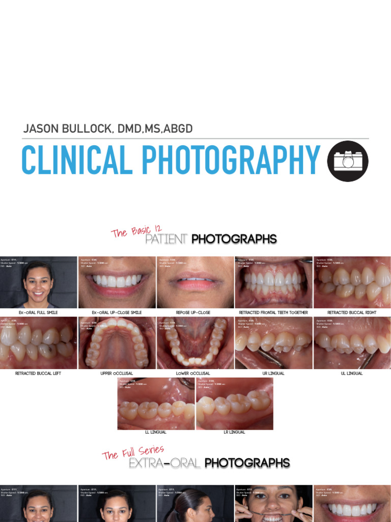 Clinical Dental Photography Guide | PDF | Shutter Speed | Film Speed