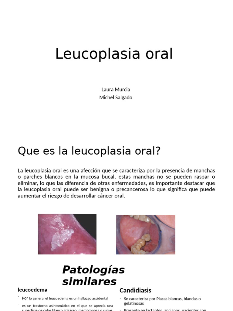 Leucoplasia Oral | PDF | Candidiasis | Enfermedades y trastornos humanos