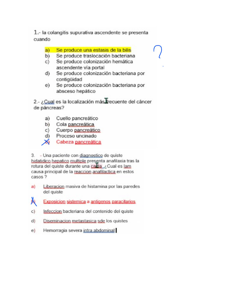 Tipos de Coledococele y Dilataciones Biliares | PDF