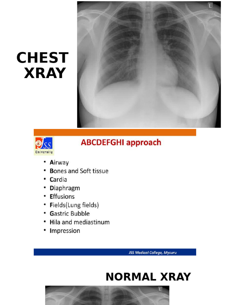 chest XRAY | PDF