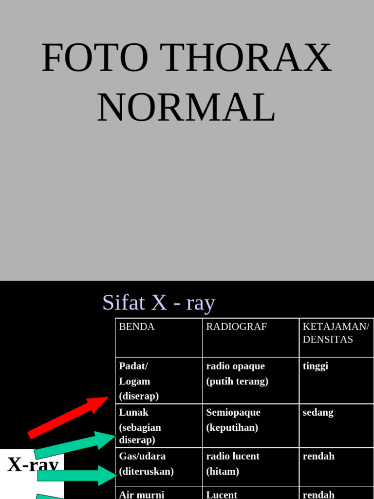 Thorax Normal | PDF