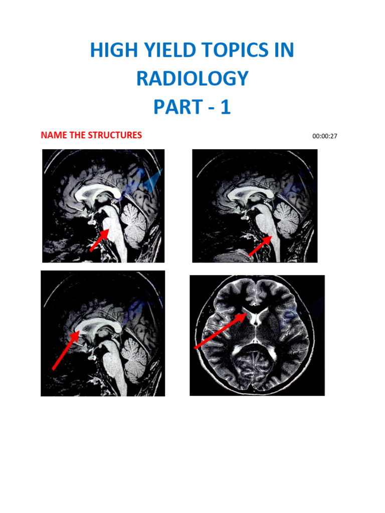 High Yield Radiology Topics: MRI Brain Structures | PDF