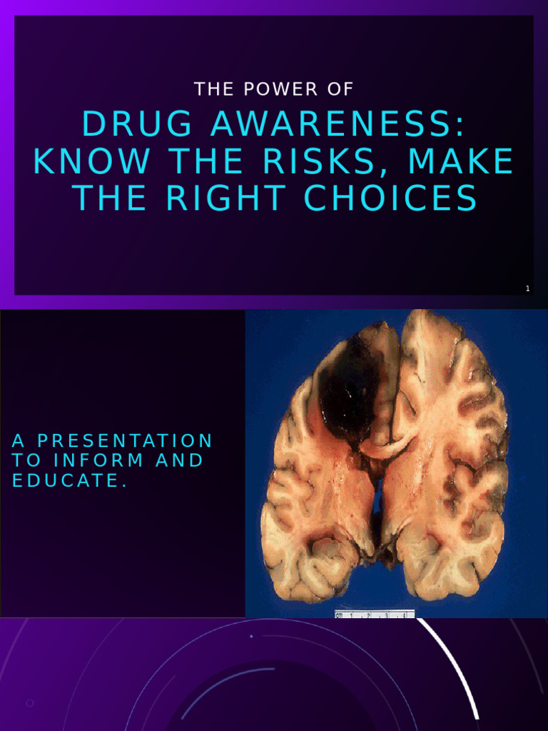 Drug Awareness: Risks and Choices | PDF | Drugs | Cannabis (Drug)