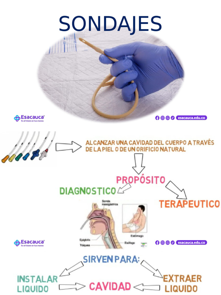 Tipos de Sondas Médicas y Usos | PDF