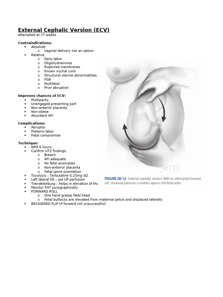External Cephalic Version | PDF