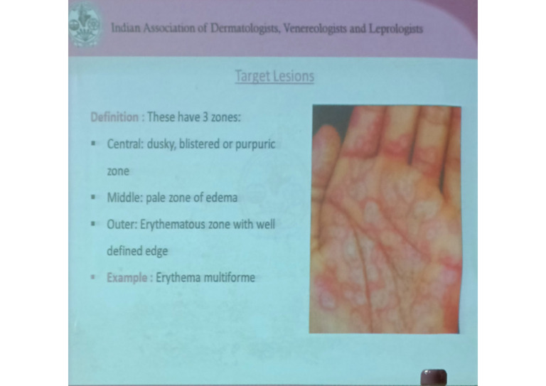 Target Lesions | PDF