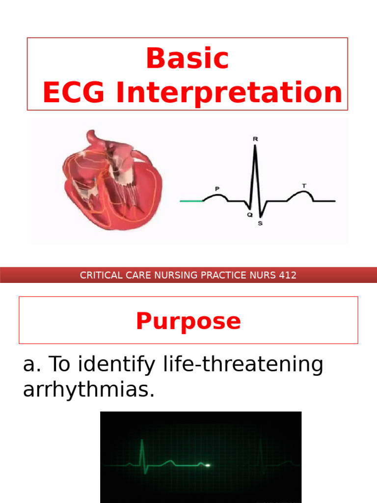 Basic ECG Interpretation | PDF | Electrocardiography | Heart