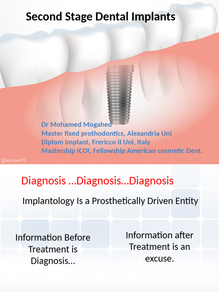 Second Stage Dental Implants | PDF